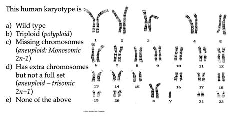 Solved This Human Karyotype Is Ir 3 A Wild Type B Triploid