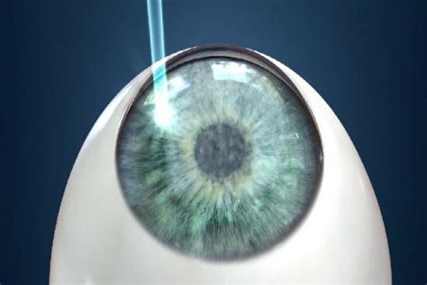 Femto Lasik And Presbyond Turkey Top 3 Clinics Andprices