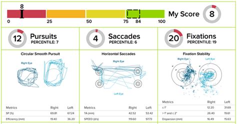 Ocular Motor Dysfunction Vision And Learning Center