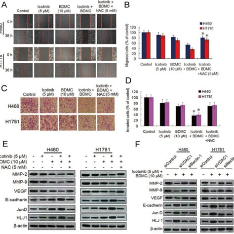 Icotinib Plus Bdmc Inhibits Cell Migration And Invasion In Egfr Tki
