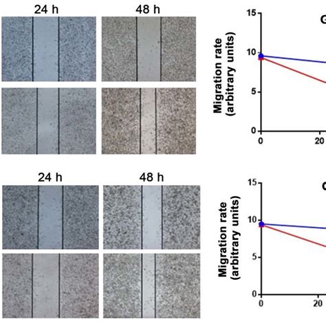 Tufm Silencing Suppresses The Lateral Migration Of Gist T1 And Gist Ir Download Scientific