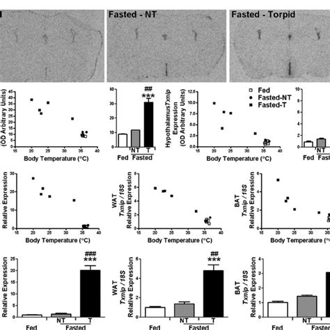 Txnip Expression Is Increased In The Hypothalamus Of Gpr50 Ϫ Ϫ Mice Download Scientific