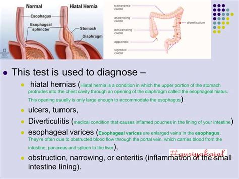 Radiological Procedure Of Gi Tract 01 Pptx