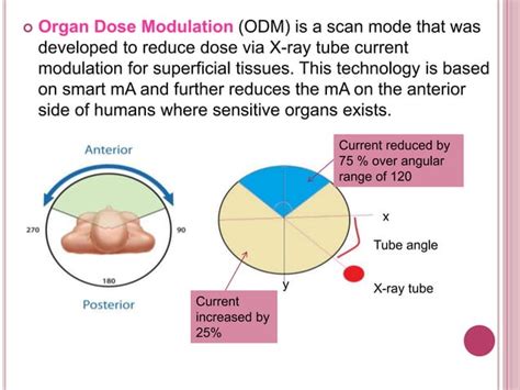 Ct Radiation Dose Reduction Pptx Digital Audio Computer Software And Applications