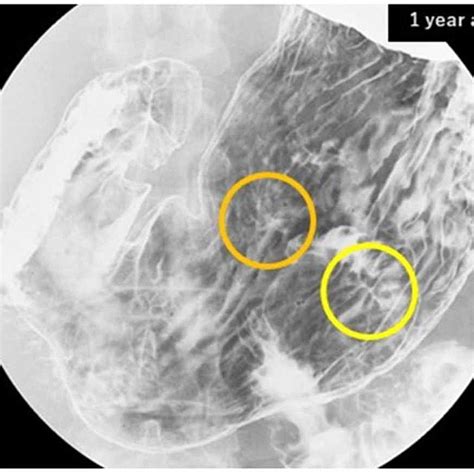Fluoroscopic Imaging Performed At A Regular Annual Medical Download