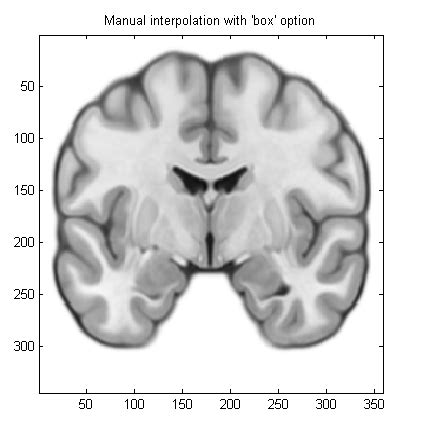 How To Avoid Image Display Artifacts In Matlab Stack Overflow