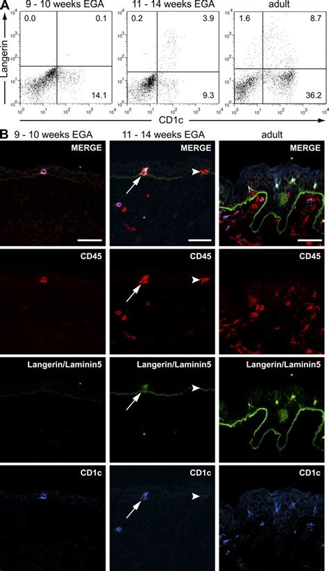 Epidermal Leukocytes Sequentially Acquire Cd1c And Langerin Cd1c And