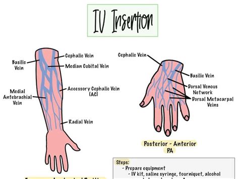 IV Insertion Cheat Sheet Etsy Nursing Babe Studying Cheat Sheets Medical Babe Stuff