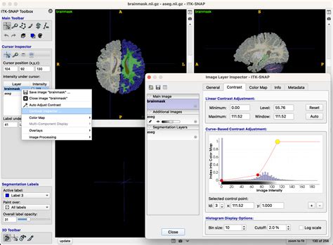 ITK Snap Tutorial The ITK Snap GUI Andy S Brain Book Documentation
