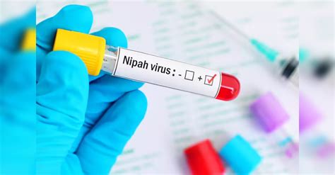 Kerala Intensifies Fever Surveillance Amid Nipah Virus Threat
