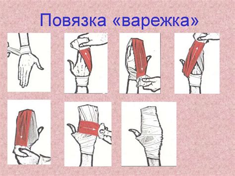 Походная медицина презентация онлайн
