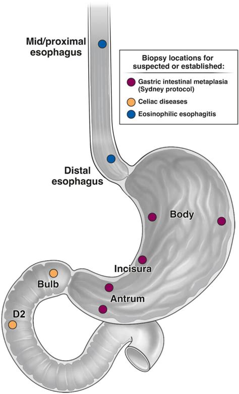 Nine Tips To Improve Your Upper Endoscopy Exams American