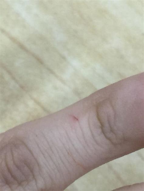 被一个月的小猫抓伤