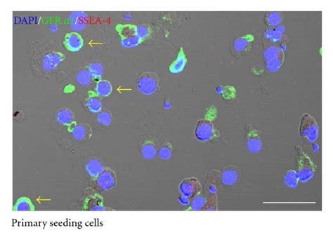 Characterization Of Spermatogonial Stem Cells Sscs A Expression Of