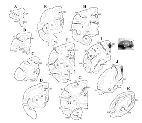 Neural Connections Of The Posteromedial Cortex In The Macaque Abstract Europe PMC