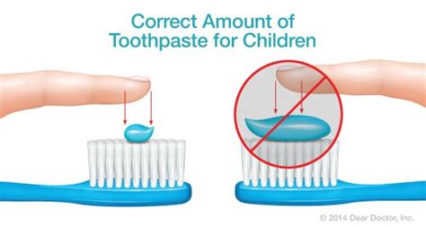 საბავშვო კბილის პასტა როგორ შევარჩიოთ