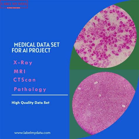 Label My Data On Linkedin Labelmydata Medicaldata Dataforgood Datacollection Datalabeling