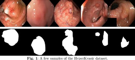 Using Diffusion Models To Generate Synthetic Labelled Data For Medical Image Segmentation