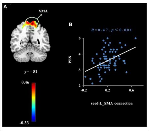 Cluster Whose Functional Connectivity Strength With The Right Download Scientific Diagram
