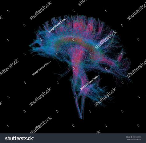 Dti Scan Brain Over 9 Royalty Free Licensable Stock Illustrations And Drawings Shutterstock