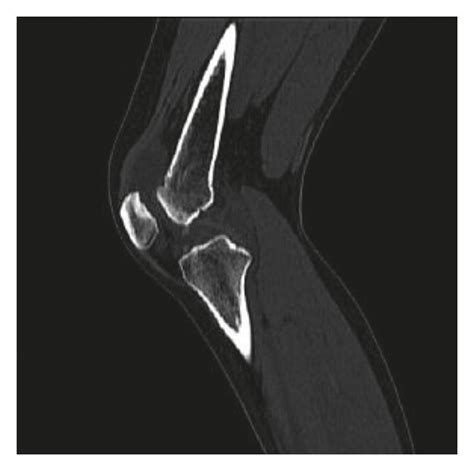 Results Of Ct Image Reconstruction With Different Algorithms Note A
