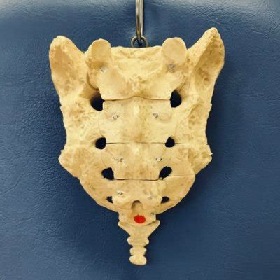 仙骨バランス回復センター On Twitter 50代の女性が腰部ヘルニアからの足のしびれ、ムチウチからの肩、首のコリで初来院。2日後の