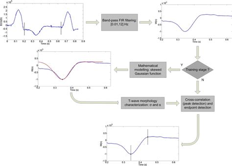 Overall View Of The T Wave Detection And T Wave End Location Algorithm