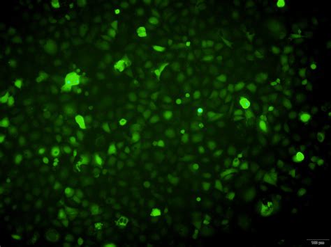 慢病毒、腺相关病毒包装价格低至2500元，快至2周发货 赛业生物