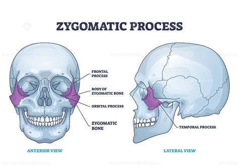 Zygomatic Process As Human Cheek Bone Skeleton Anatomy Outline Diagram Skeleton Anatomy