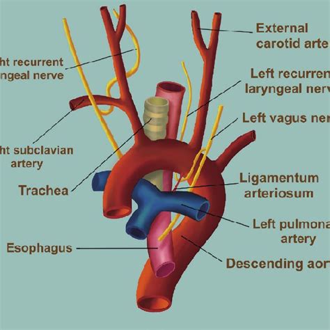 Echocardiogram Showing Persistence Of The Patent Ductus Arteriosus Download Scientific Diagram