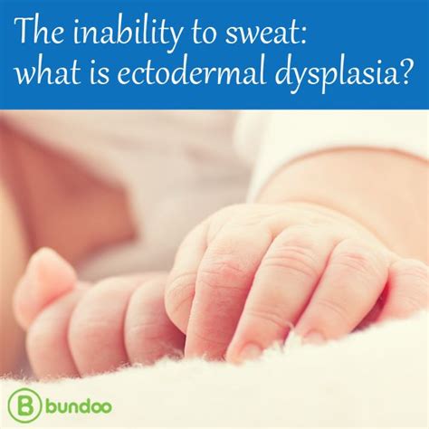 The Inability To Sweat What Is Ectodermal Dysplasia Sweat Genetic