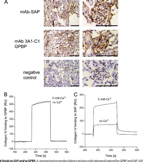 Figure 1 From Goodpasture Antigen Binding Protein Ceramide Transporter