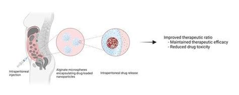 Faheez Mohamed On Linkedin Alginate Microsphere Encapsulation Of Drug Loaded Nanoparticles A