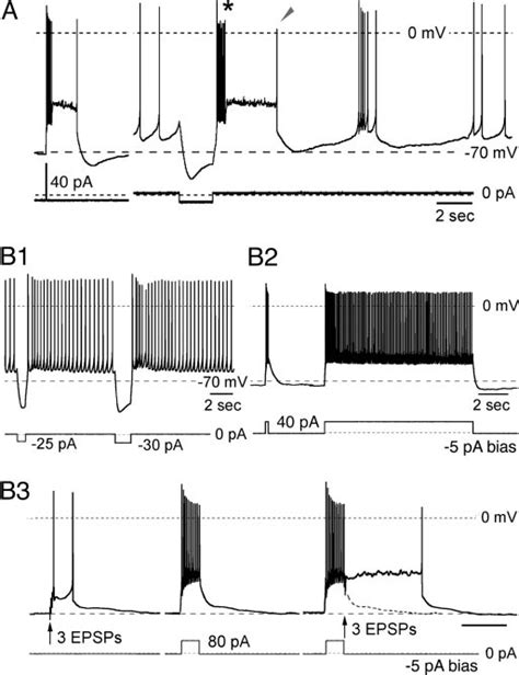 Subthalamic Plateau Potentials In Whole Cell Recordings A Prototypic