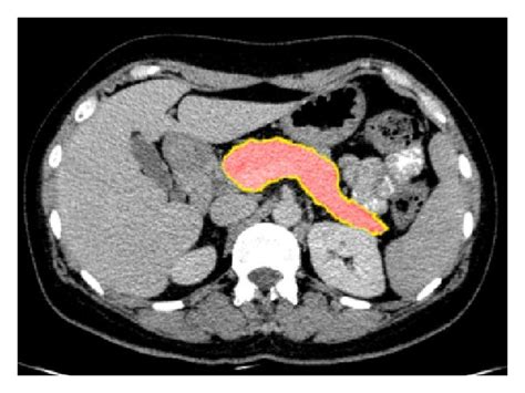 Exemplary Segmentation Results Of Our Proposed Method Based On Download Scientific Diagram