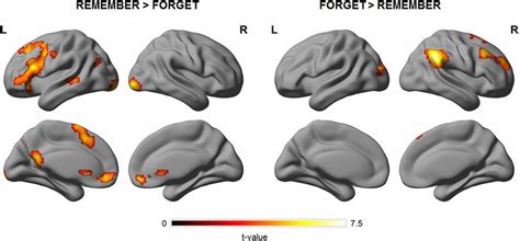 Whole Brain Statistical Parametric Maps Representing Brain Activation Download Scientific