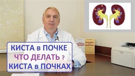 КИСТА ПОЧКИ причины КАК ЛЕЧИТЬ Кисты в ПОЧКАХ опасно ли это нужна