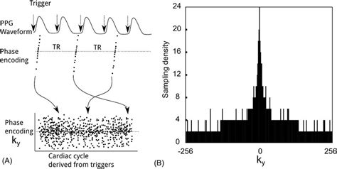 Data Reordering And Variable Density Sampling A Retrospective Ppg Download Scientific