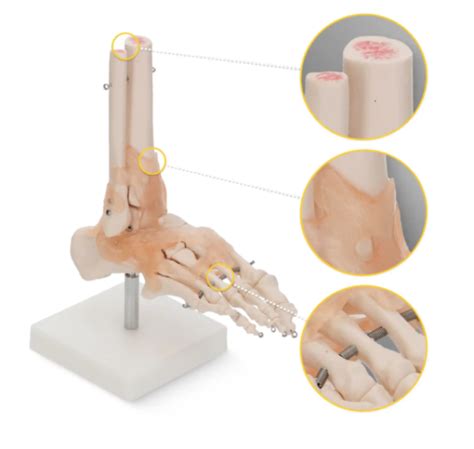 Foot Joint With Ligaments Anatomical Model Medpoint