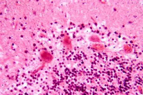 Human Motor Cortex Photomicrograph Showing Pyramidal Neurons In Cortical Layers Responsible For