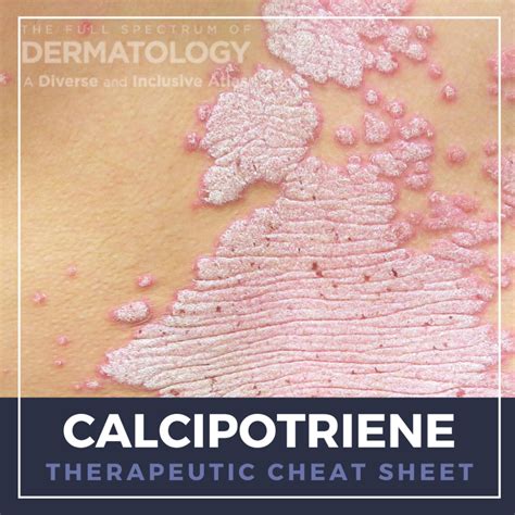 Calcipotriene Cream Archives Next Steps In Dermatology