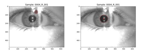Example Of Boundary Localization For The Image From The Retica Iris Download Scientific Diagram