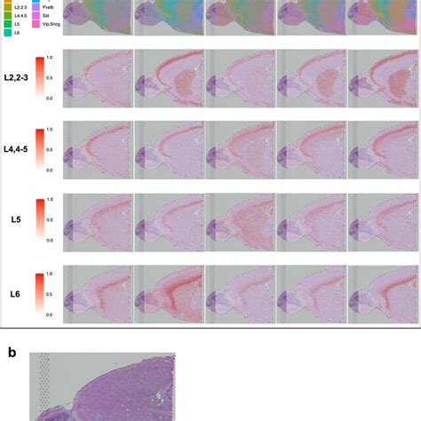 Cell Type Deconvolution Results For 10x Visium Mouse Brain Serial