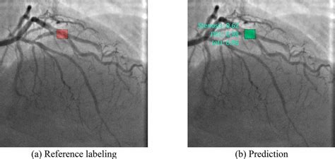 Example Of The Best Prediction Compared To Reference Labeling Data Of Download Scientific