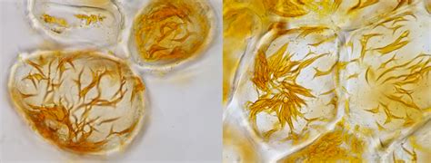 Chromoplasts Microscopy Of Nature