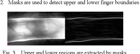 Figure 3 From Finger Vein Pattern Extraction Improvement By Enhance Maximum Curvature And Frangi