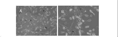 Astrocyte Cell Line Cultured In The Astrosit Medium Light Microscope
