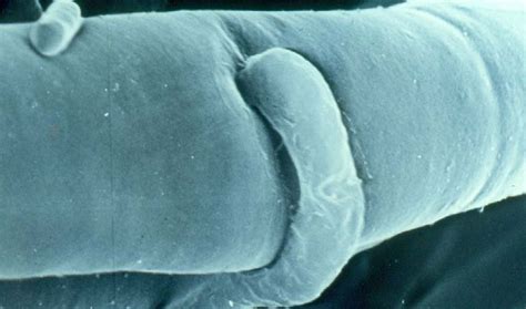 The Use Of Pseudomonas Spp As Bacterial Biocontrol Agents To Control Plant Diseases Burleigh