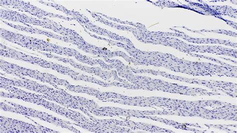 Section Of Myocardium Filmed Under Light Micrograph With 200 Magnification On Bright Field Stock