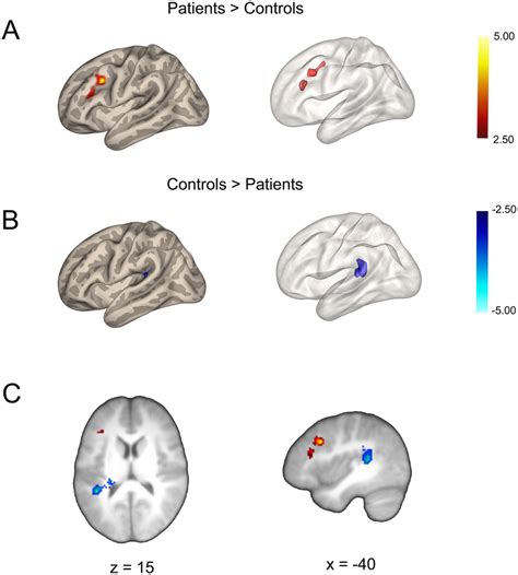 Group Effects For The Seed Based Functional Connectivity Analysis For